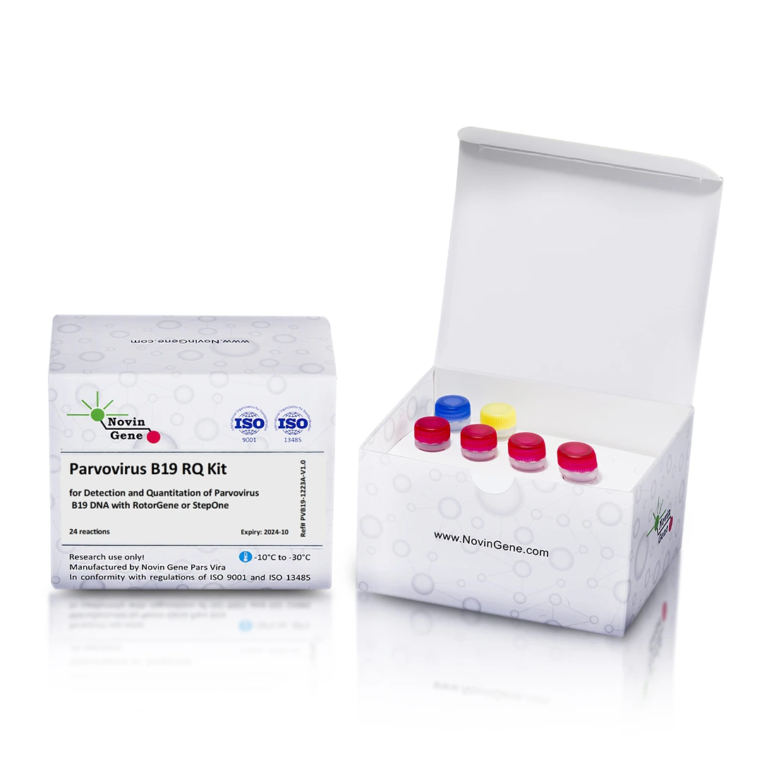 Parvovirus B19 Detection and Quantitation kit – Novingene